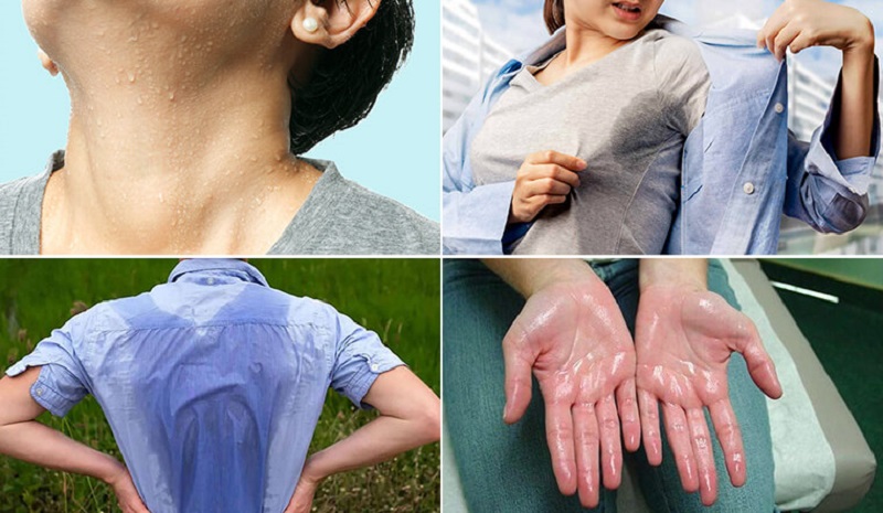 Đổ mồ hôi nhiều dù không vận động cơ thể đang cảnh báo...
